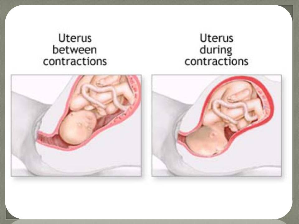 Free Contractions Clip Art
