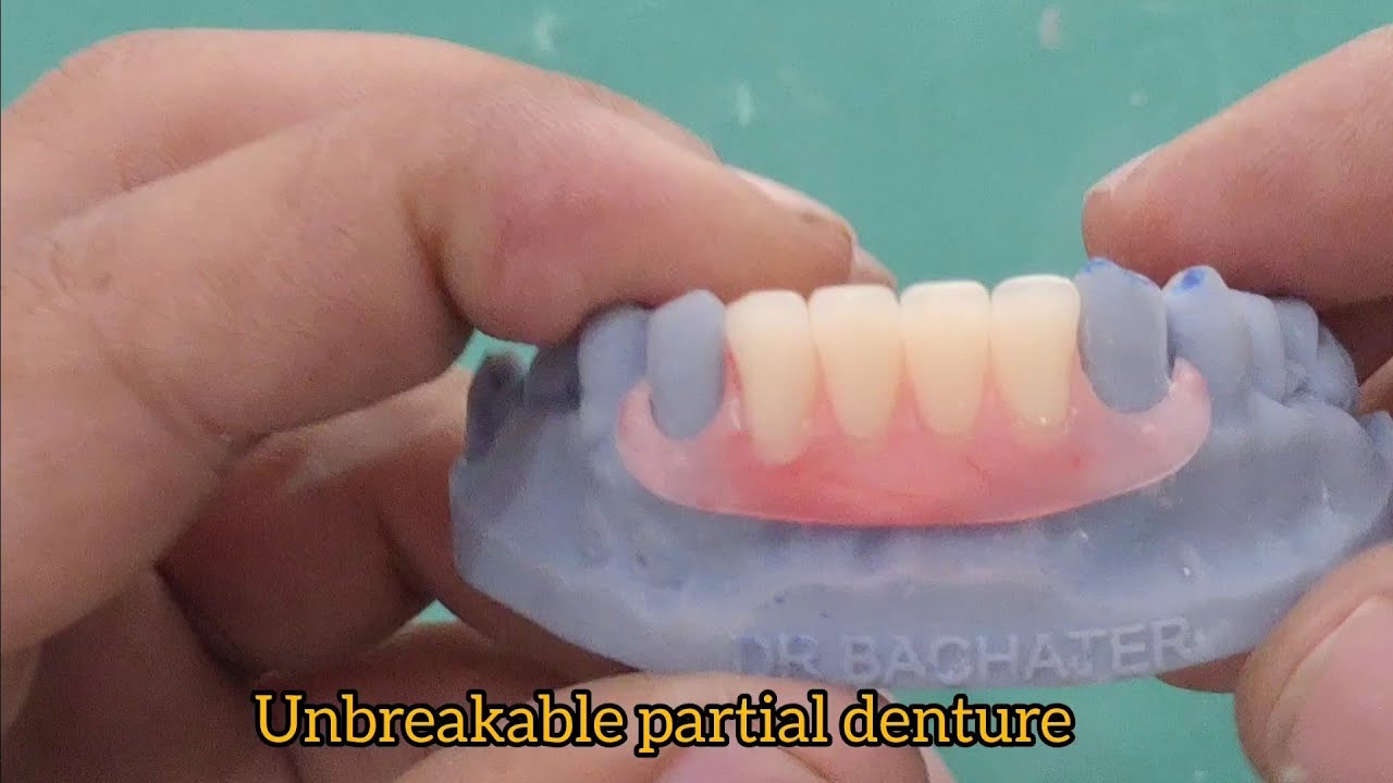 Flexible Removable Partial Denture Dentistry Dental Dentist Flexible