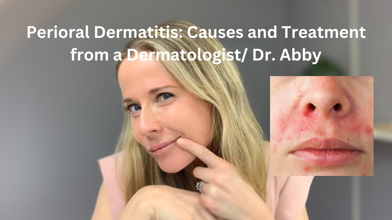 Perioral Dermatitis Causes And Treatment From A Dermatologist Youtube