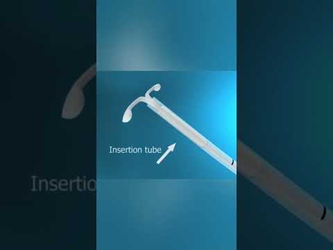 Animation For Insertion Of Mirena Iud Youtube
