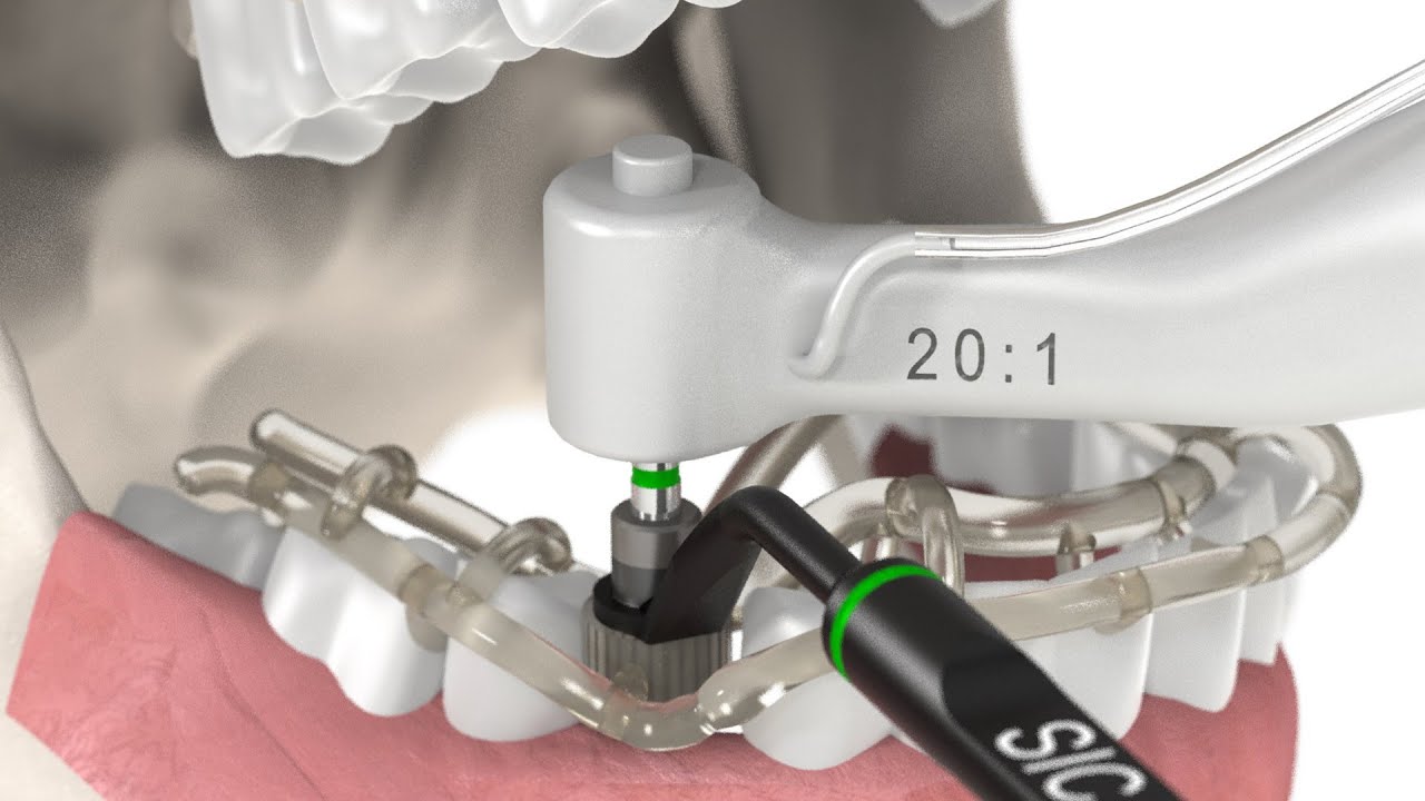 Dental Implant Surgical Guide