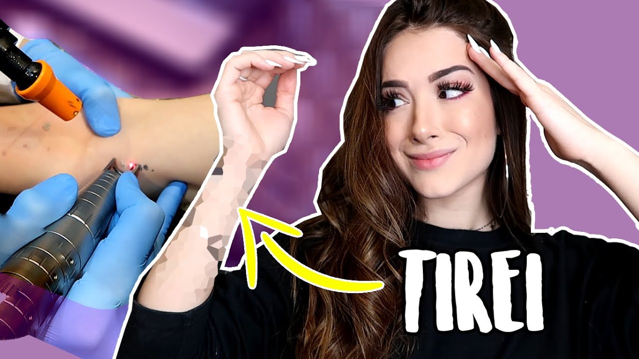 Removi Mais 3 Tatuagens Em Um Dia Me Arrependi Youtube