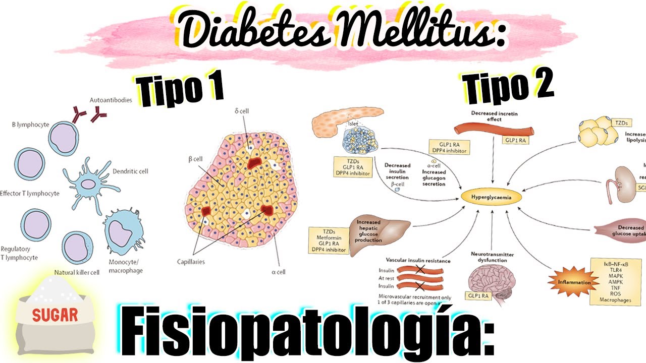 Diagrama De Fisiopatología De La Diabetes Tipo 2
