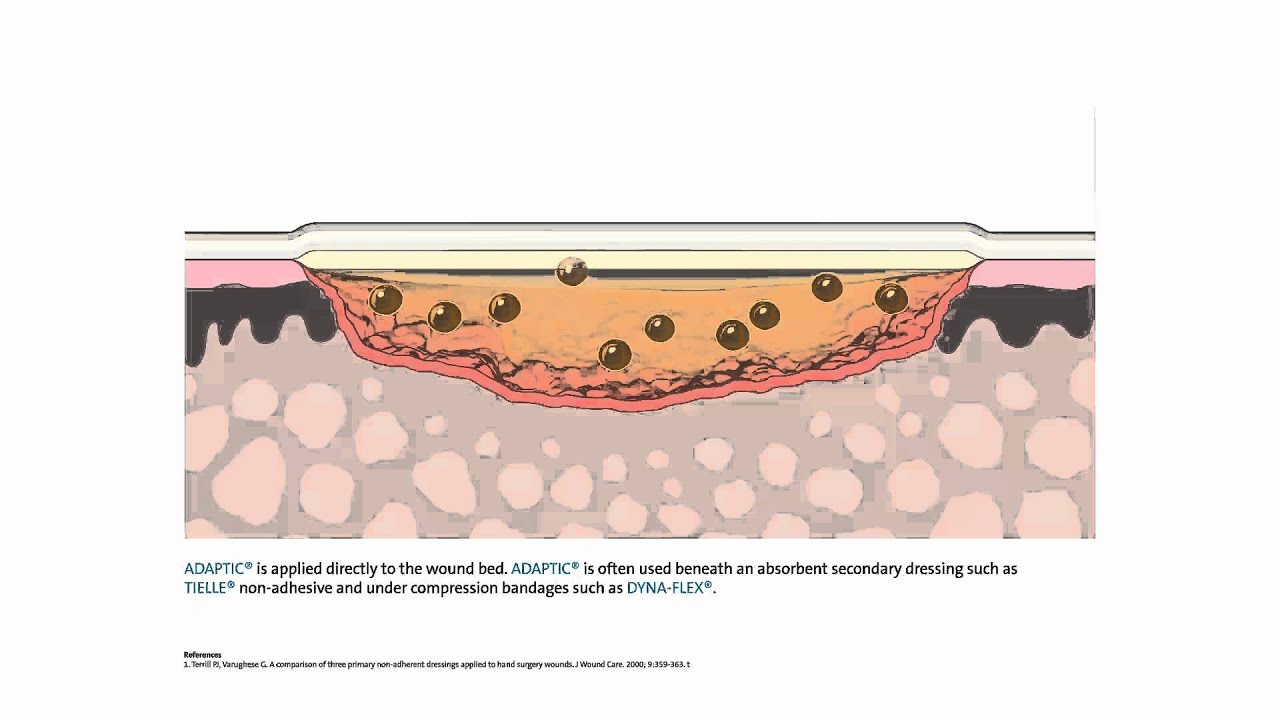 Adaptic Touch Wound Dressing Reputable Site Www Pinnaxis