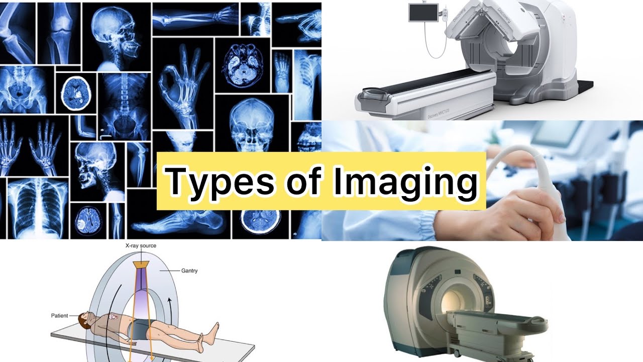 What Are Medical Imaging Techniques At Gabrielle Gonzales Blog