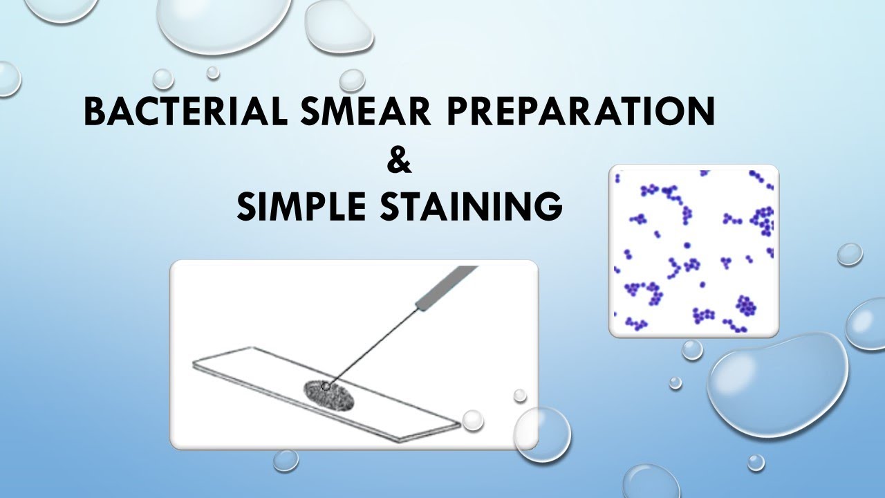Bacterial Smear Preparation And Simple Staining Youtube