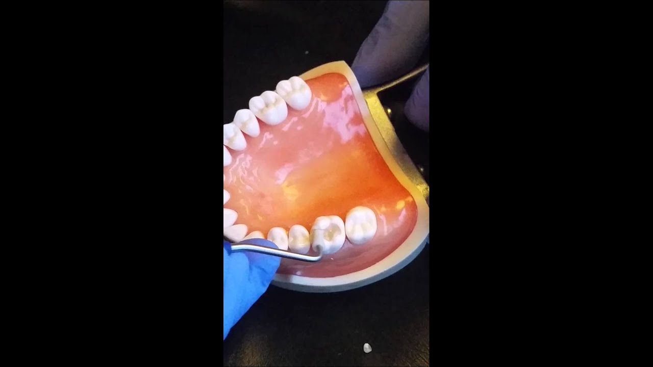 3 Mo Composite Video 2 Youtube