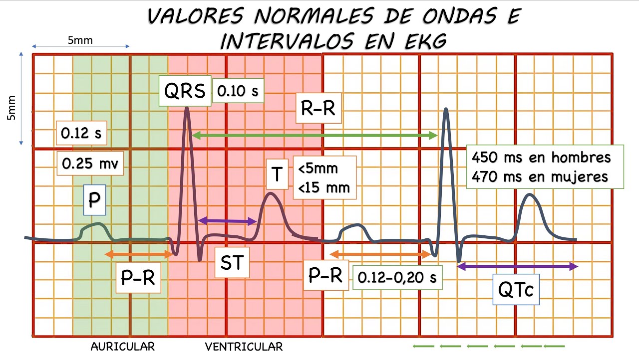 Qu Es Un Electrocardiograma Ecg Y Como Se Hace