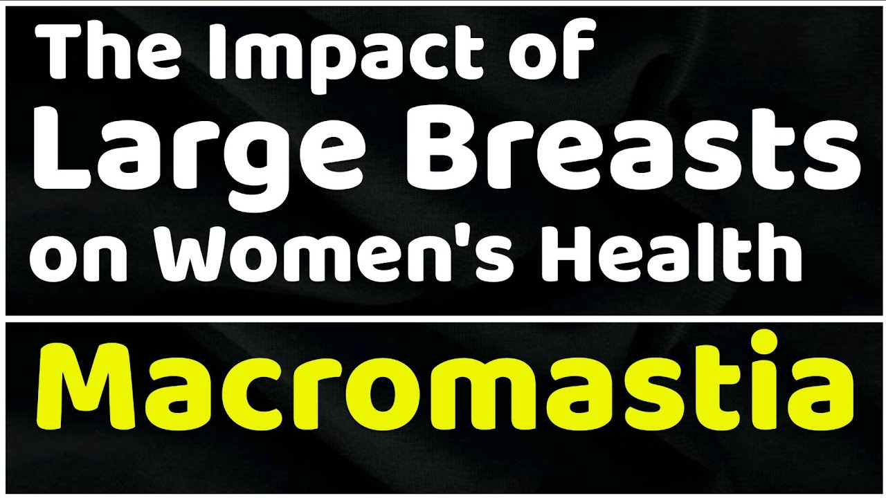Macromastia The Impact Of Large Breasts On Women S Health Youtube
