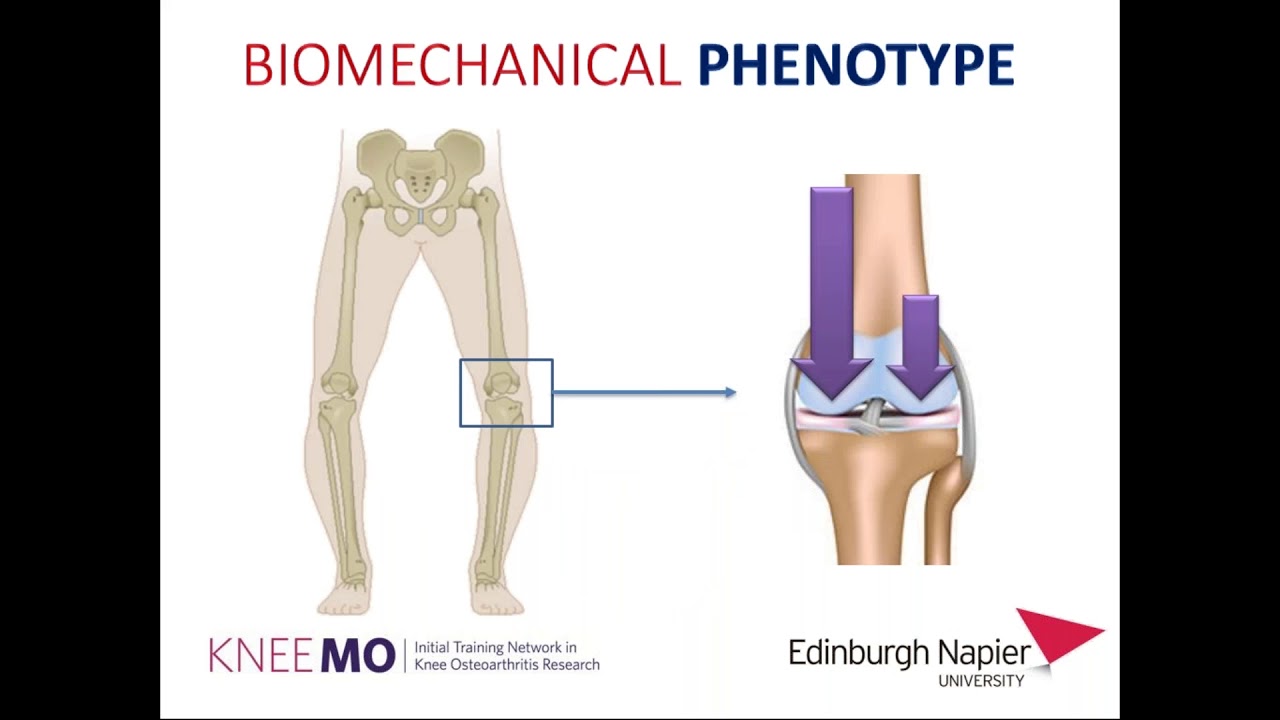 Knee Internal Contact Forces In The Knee Osteoarthritis Population