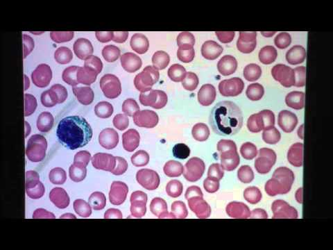 Blood Connective Tissue Youtube