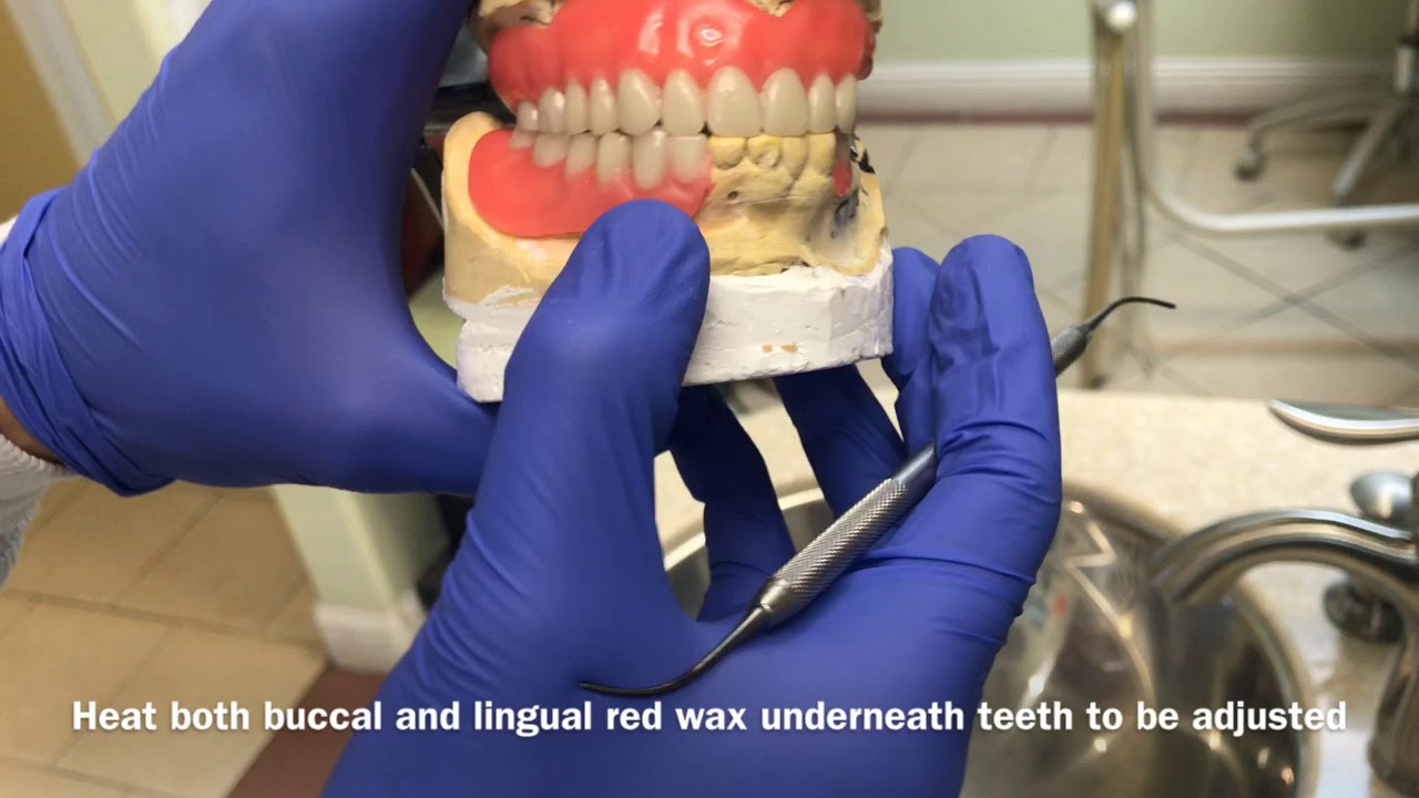 How To Fix The Wax Up Teeth During Denture Try In Step In The Office