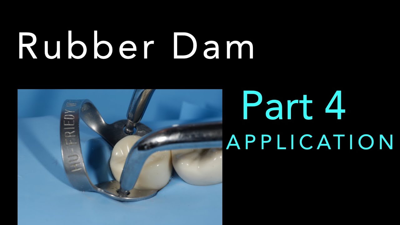 What Is A Rubber Dam Used For At Manuel Blount Blog