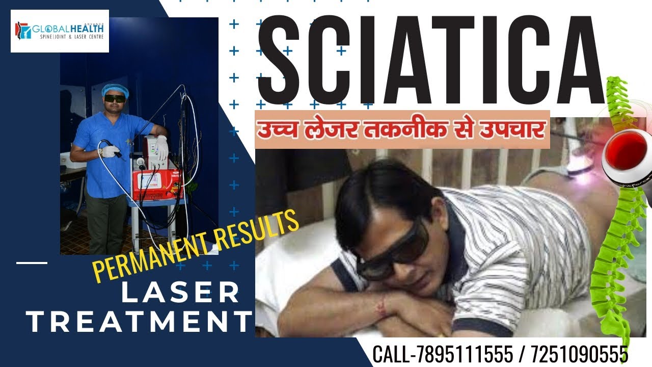 Laser Surgery For Sciatica