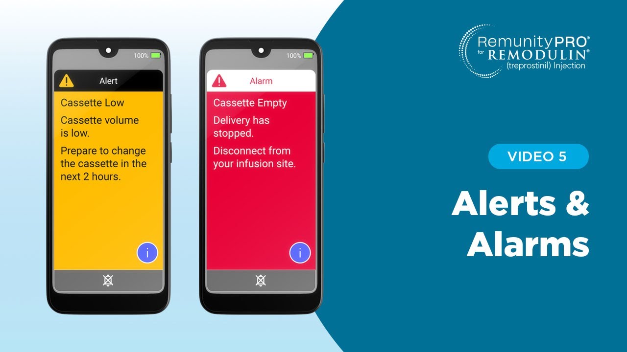 Remunitypro User Guide Video 5 Alerts Alarms Youtube
