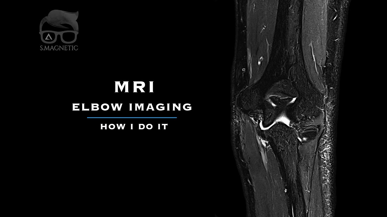 Elbow Mri Positioning Pro Techniques For Accurate Imaging