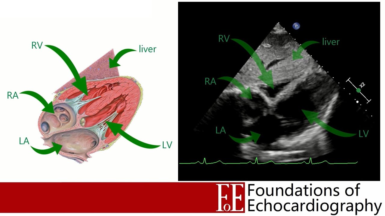 Bse Level 1 The Focused Echo