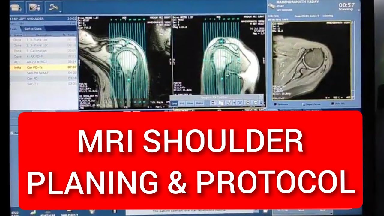 Shoulder Mri Protocol Positioning And Planning How To Do Mri Shoulder