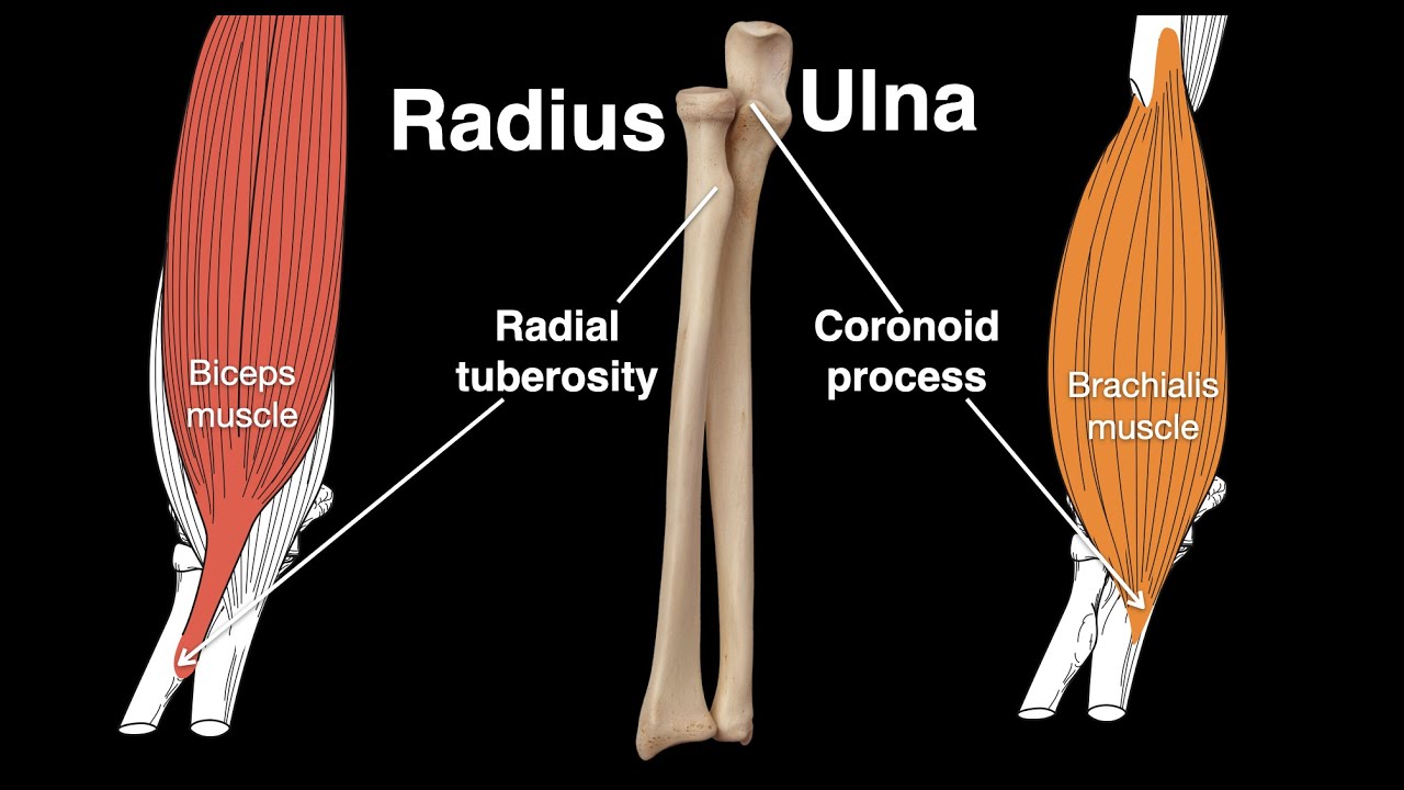 Radius And Ulna Post Traumatic Radioulnar Synostosis A Retrospective