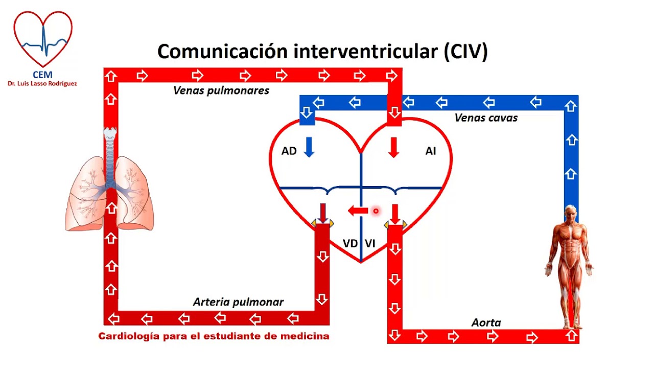 Circuito De La Comunicación Interventricular Youtube