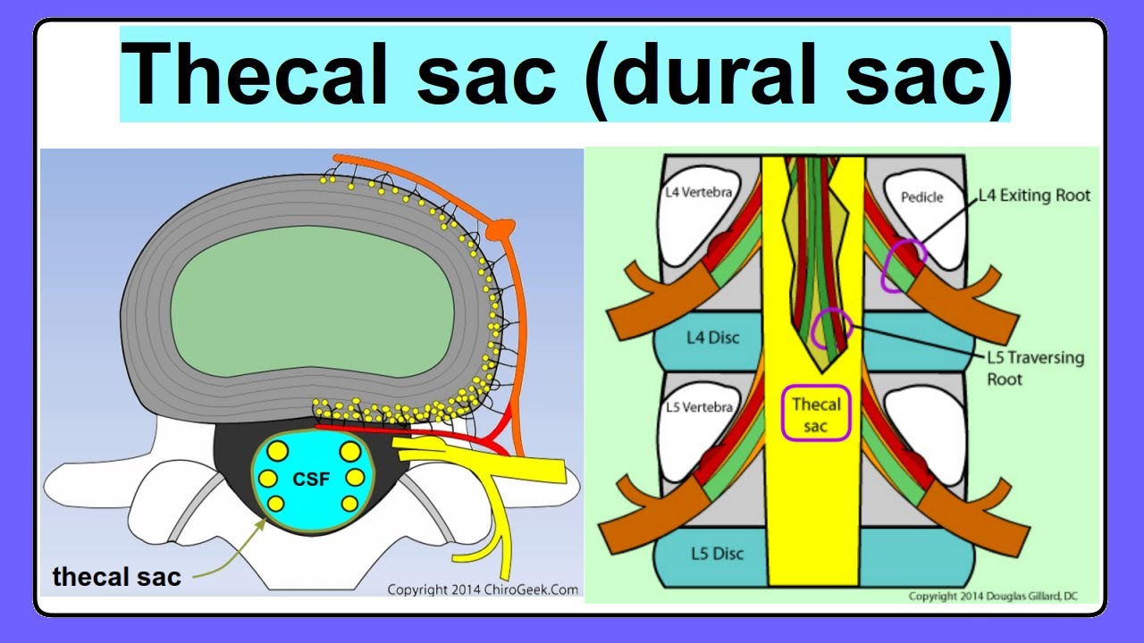 Thecal Sac Youtube