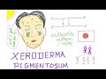 Xeroderma Pigmentosum Xp Dna Repair Disorder Explained Causes Symptoms ...