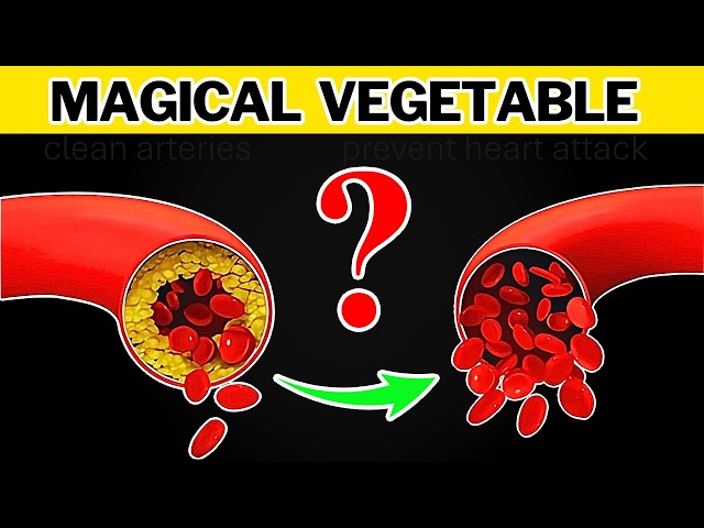 5 Best Veggies To Clean Arteries Prevent Heart Attack 377ce2