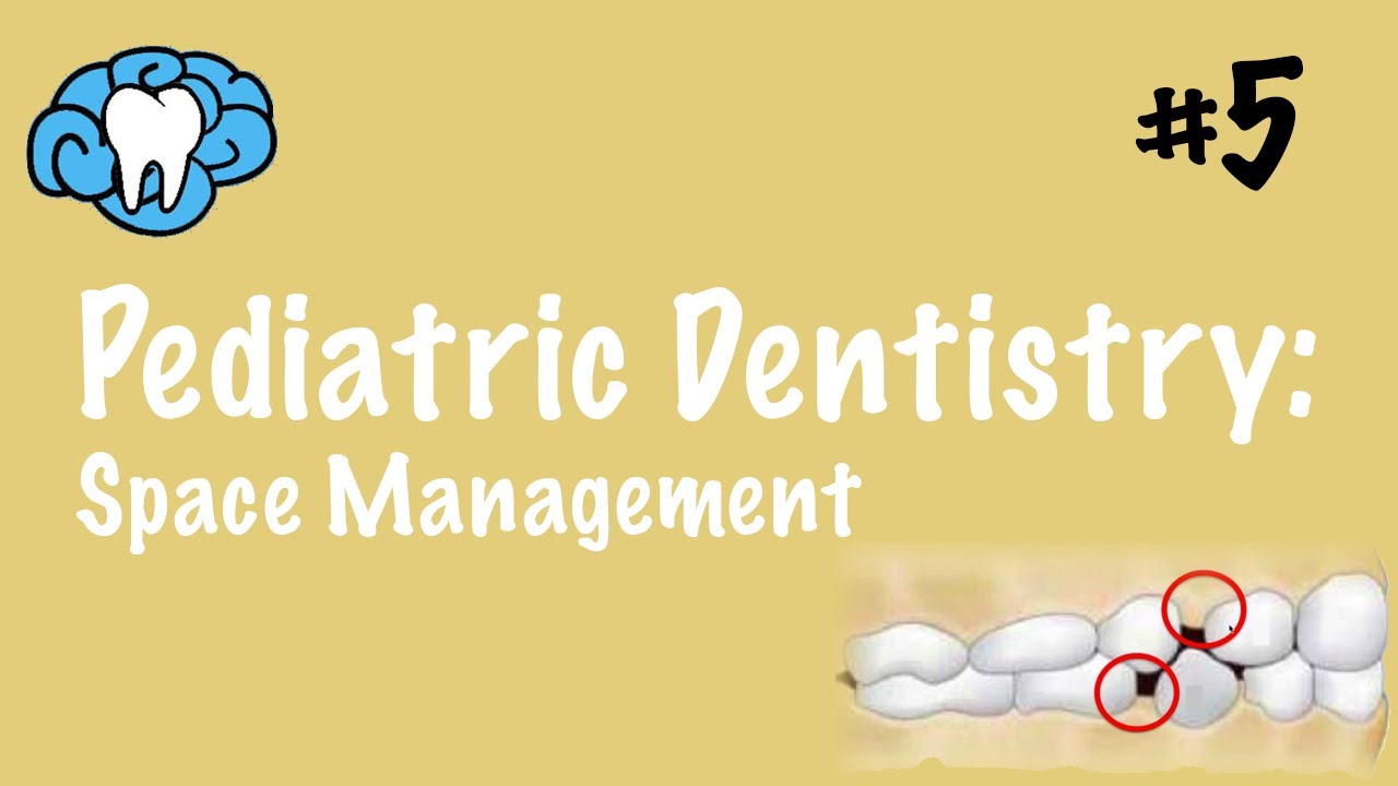 Pediatric Dentistry Space Management Inbde Adat Youtube