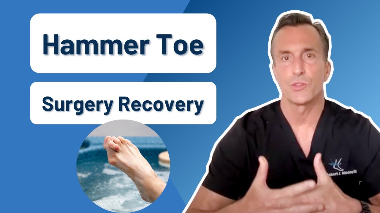 How Long Is Recovery From Hammer Toe Surgery Youtube