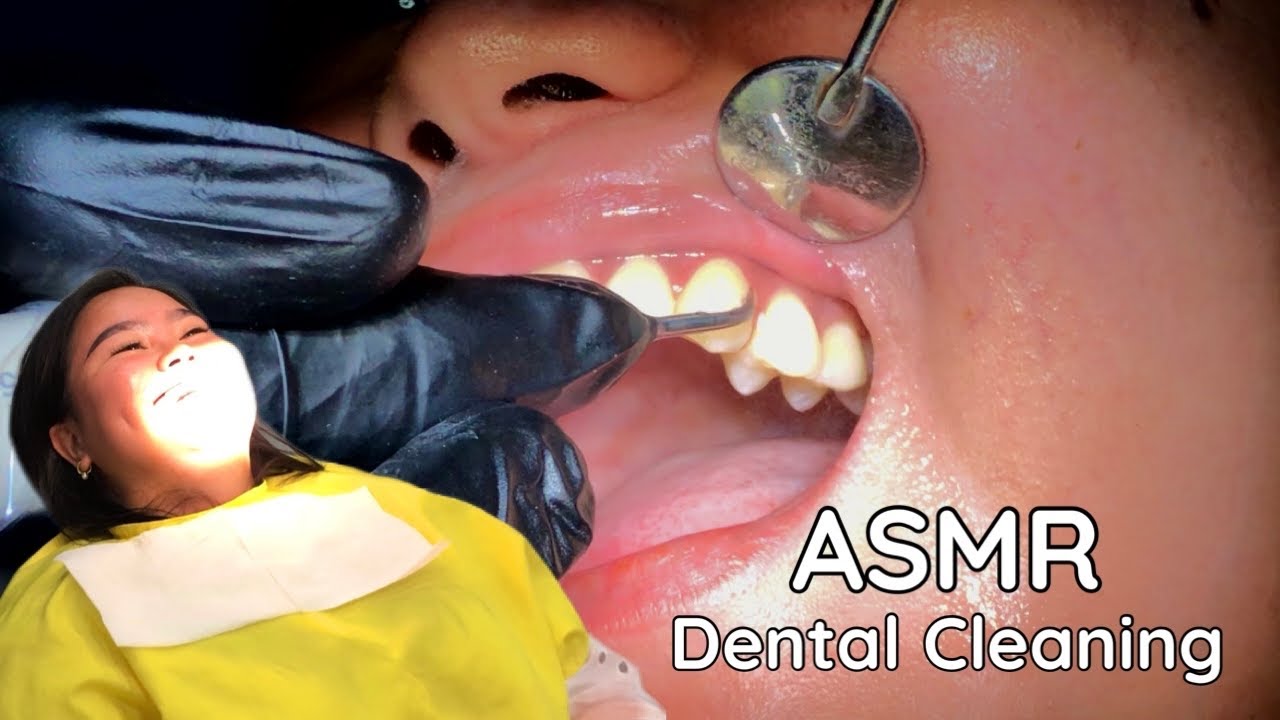 Dental Cleaning Close Up View Asmr рџ Youtube