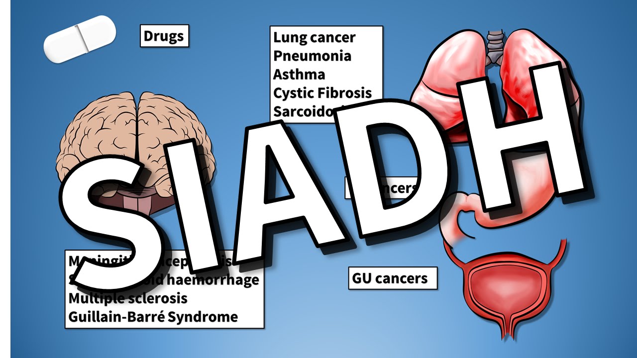 Siadh Explained Hyponatraemia Youtube