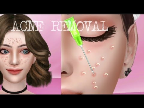 Acne Removal Asmr Youtube