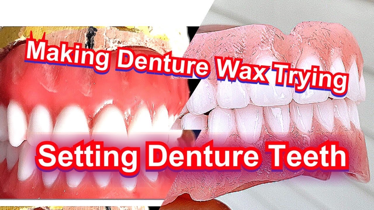 Making Of Dentures Wax Trying Youtube