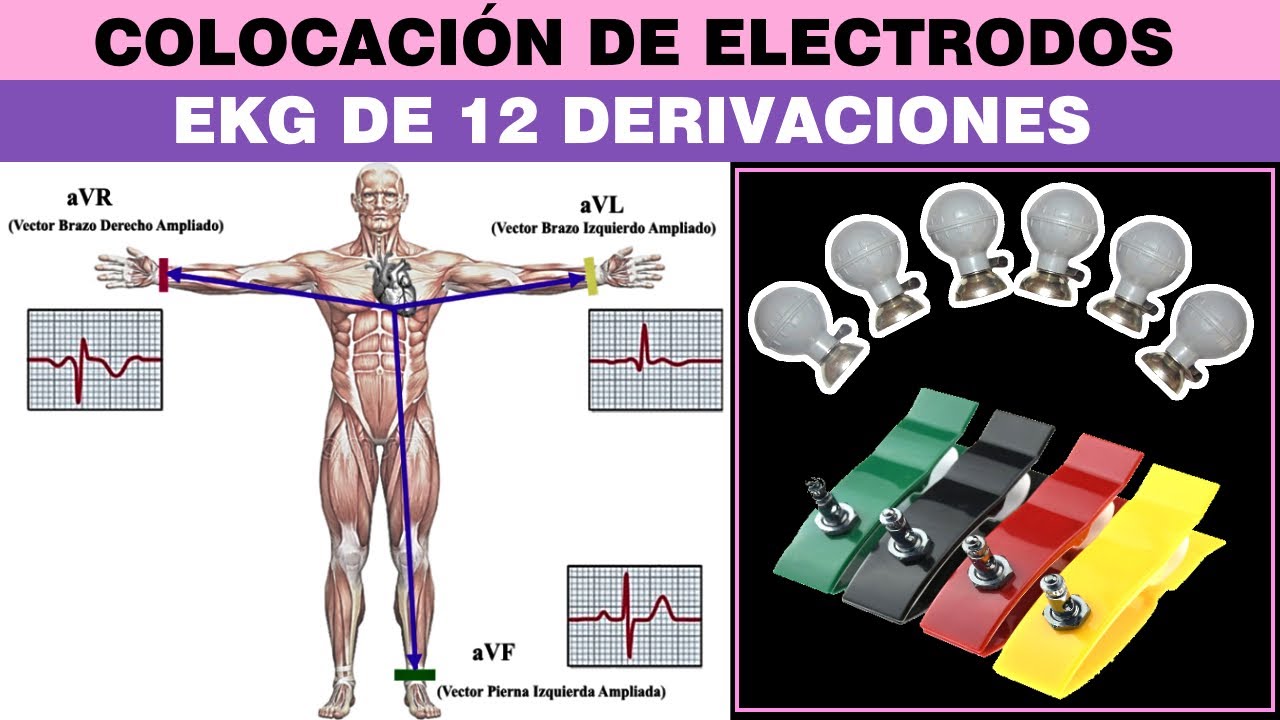 Como Colocar Electrodos Para Tomar Un Electrocardiograma Ekg De 12