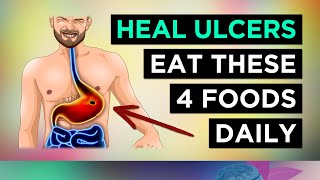 4 Foods To Heal Stomach Ulcers Eat These Everyday Doovi