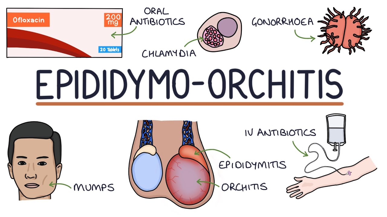 Orchitis Causes Symptoms Treatment Orchitis Epididymitis
