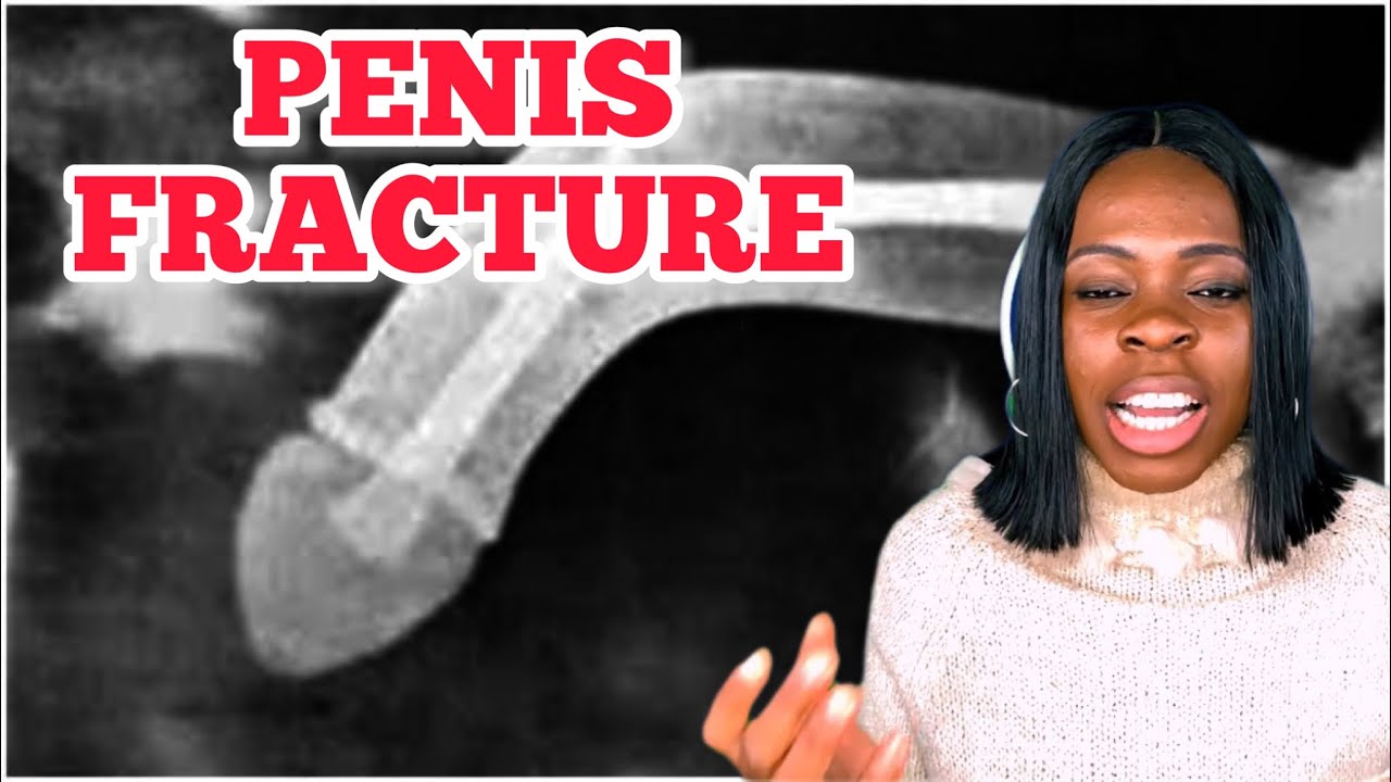 What Is Penis Fracture What Are The Causes Of Penis Fracture Can The