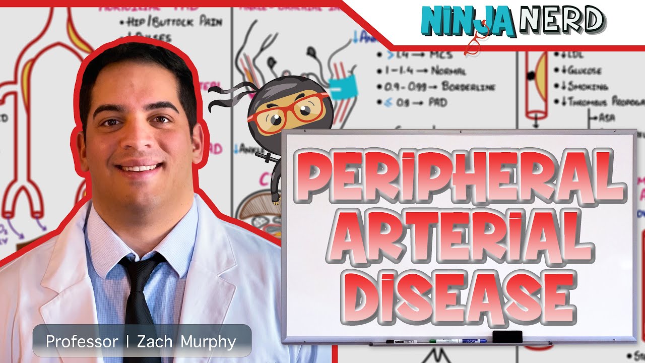 Peripheral Arterial Disease Clinical Medicine Diabetes