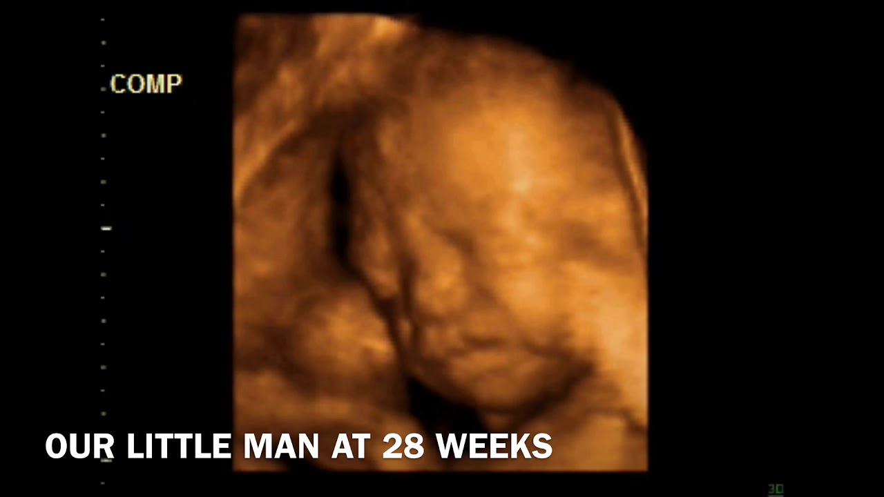 28 Weeks Ultrasound