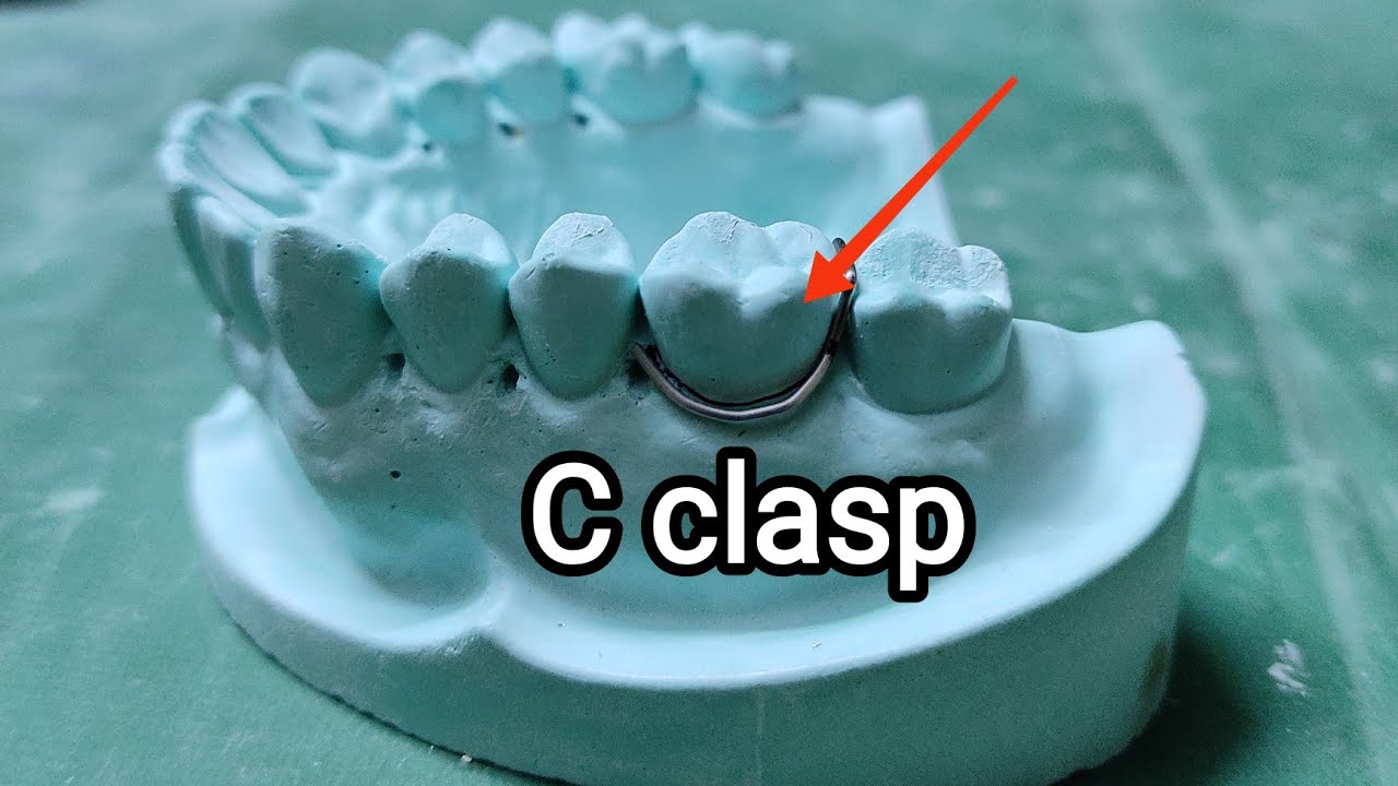 Fabrication Of C Clasp Youtube