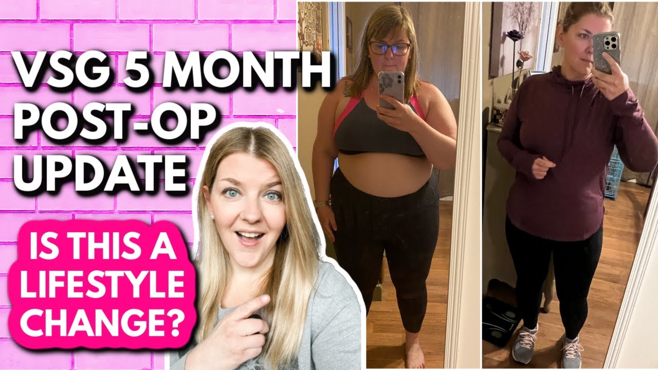 Vsg 5 Months Post Op Update 100lbs Weight Loss Journey With Gastric