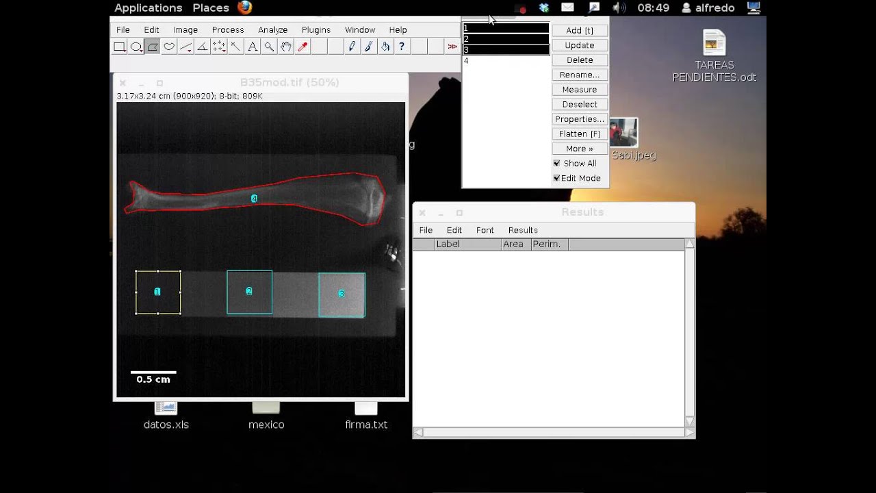 Imagej Leccion 2 Roi Manager Youtube
