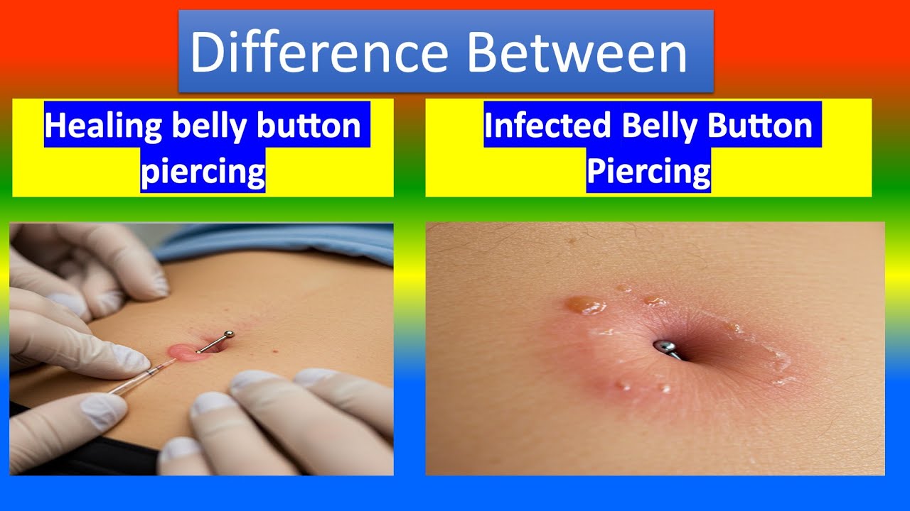What Does A Belly Piercing Look Like When It S Healing Detroit Chinatown