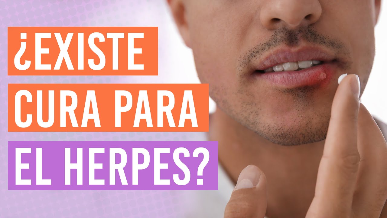 Se Puede Curar El Herpes Hay Una Cura Definitiva Youtube