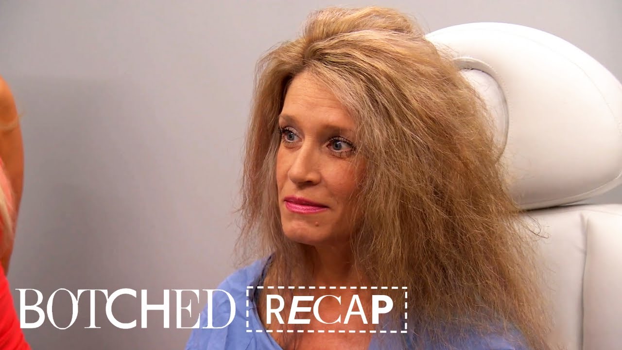 Bologna Sized Areolas To Pepperoni Size Botched Recap S6 E20 E