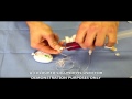 Pca Button Pump Demonstration Specific Medical Solutions Www Specmedsol ...