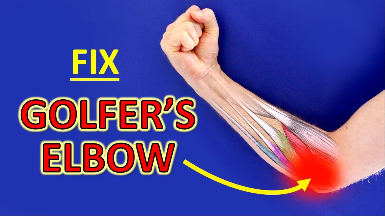 Golfers Elbow Fix At Julian Lentini Blog