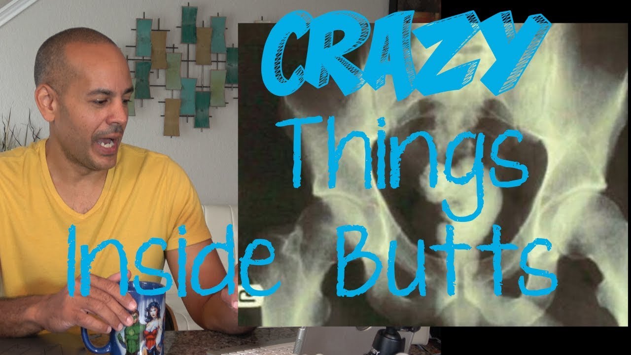 Crazy Things People Stick Up Their Butts Youtube