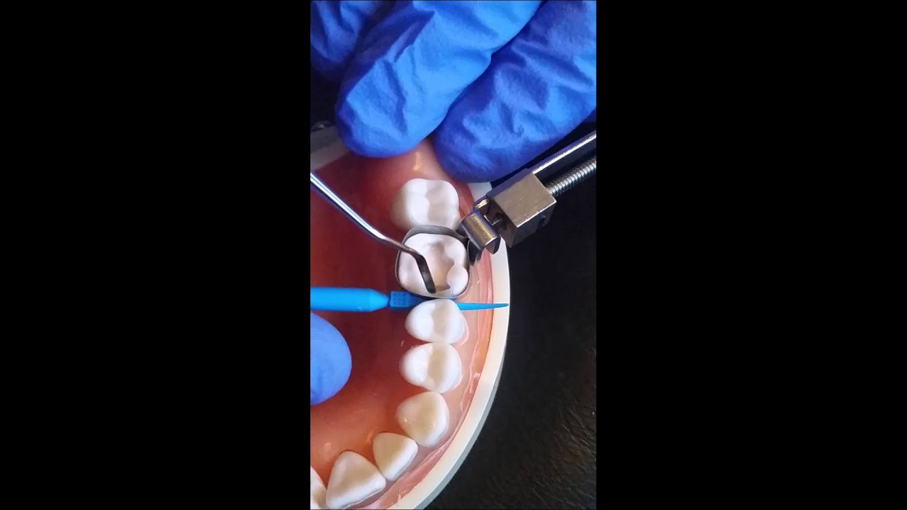 3 Mo Composite Video 1 Youtube