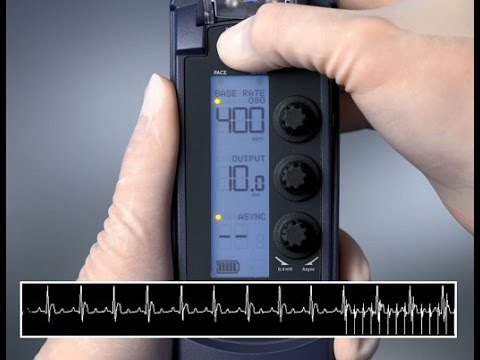 Rapid Atrial Pacing 53401 Temporary Pacemaker Youtube